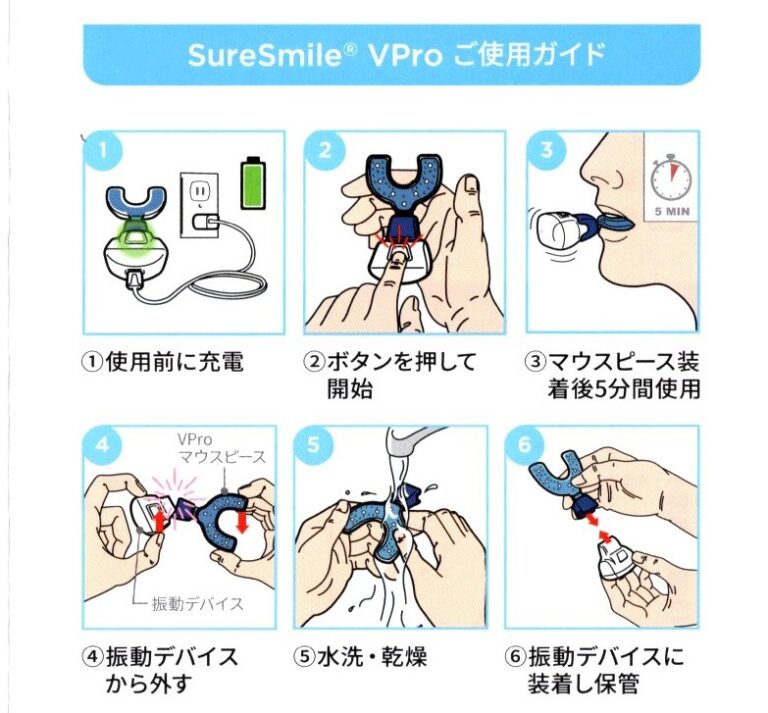 SureSmile VPro 始めました | 所沢市の矯正専門歯科 やまぐち矯正歯科